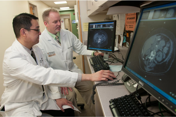 Procedure to open blocked carotid arteries tested – WashU Medicine