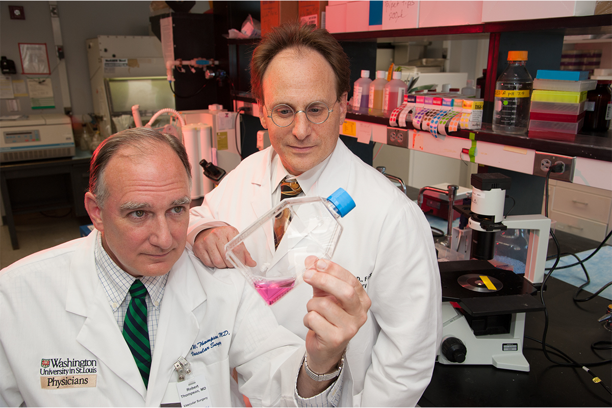 Abdominal aortic aneurysms: New study tests medicine to prevent surgery ...