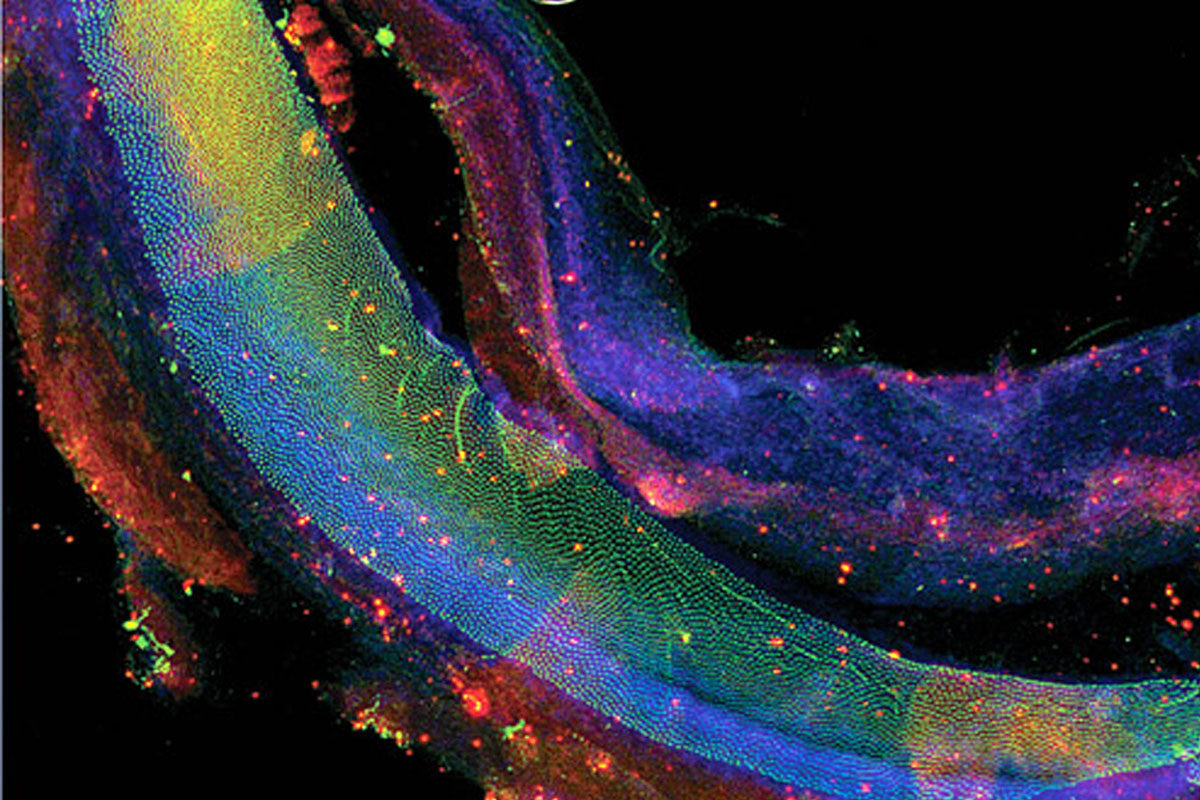 Restoring hearing loss: Chick studies show promise – WashU Medicine