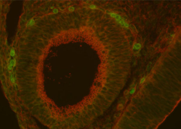 Understanding inflammation and the inner ear – WashU Medicine