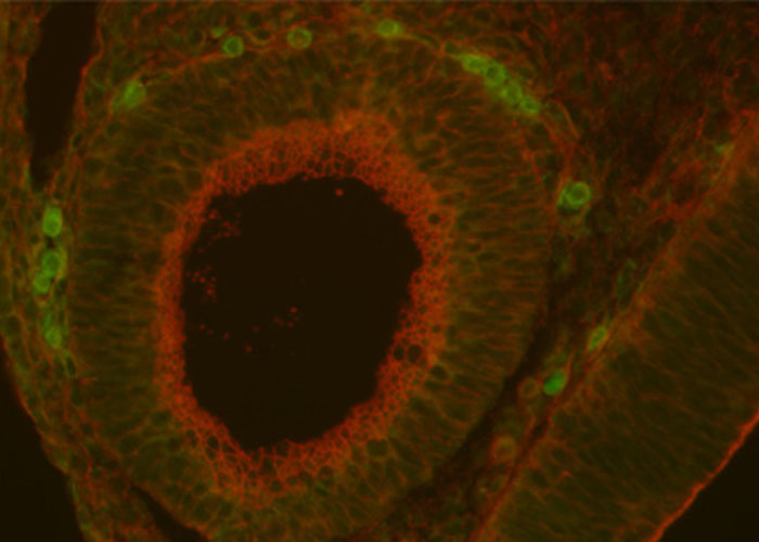 Understanding inflammation and the inner ear – WashU Medicine