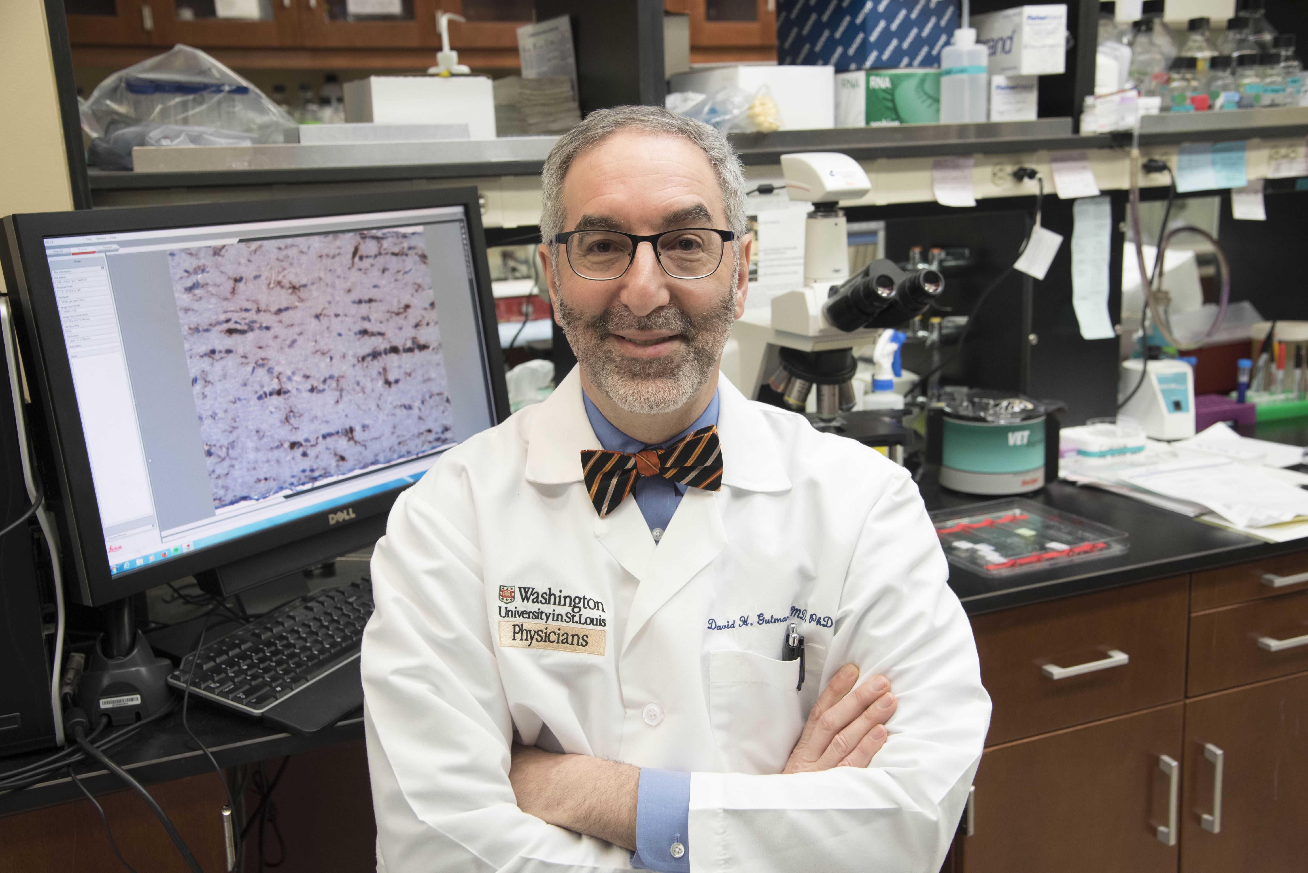 New clues identified in childhood cancer syndrome – WashU Medicine