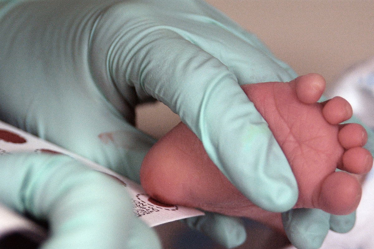 Newborn screening test developed for rare, deadly neurological disorder ...