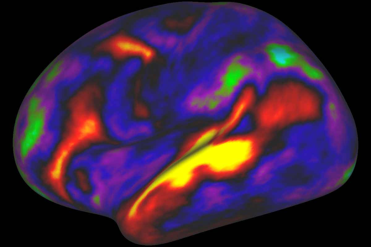 Updated brain map identifies nearly 100 new regions – WashU Medicine