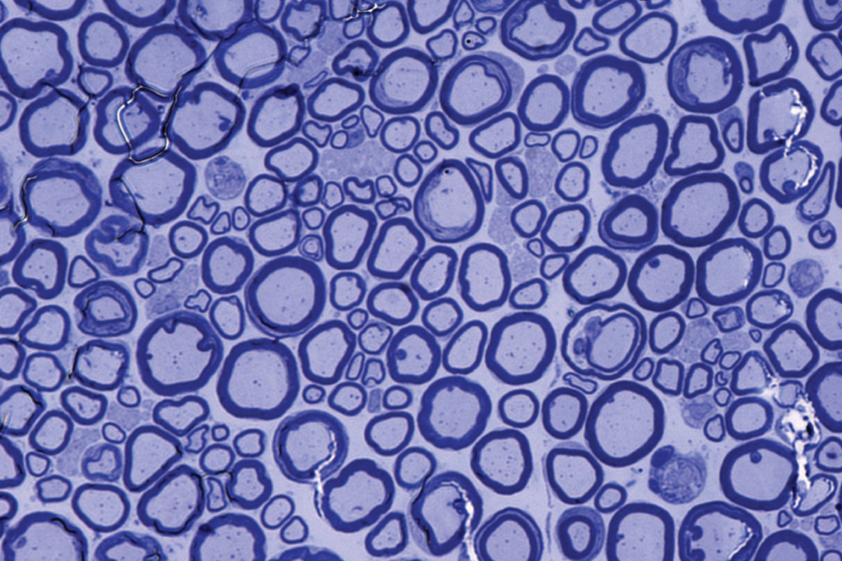 Beneficial role clarified for brain protein associated with mad cow ...