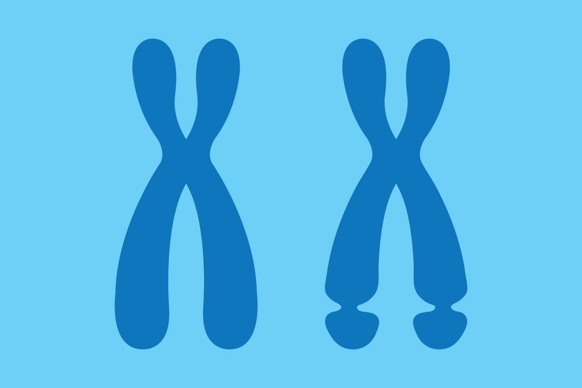 New explanation offered for symptoms of fragile X syndrome – WashU Medicine