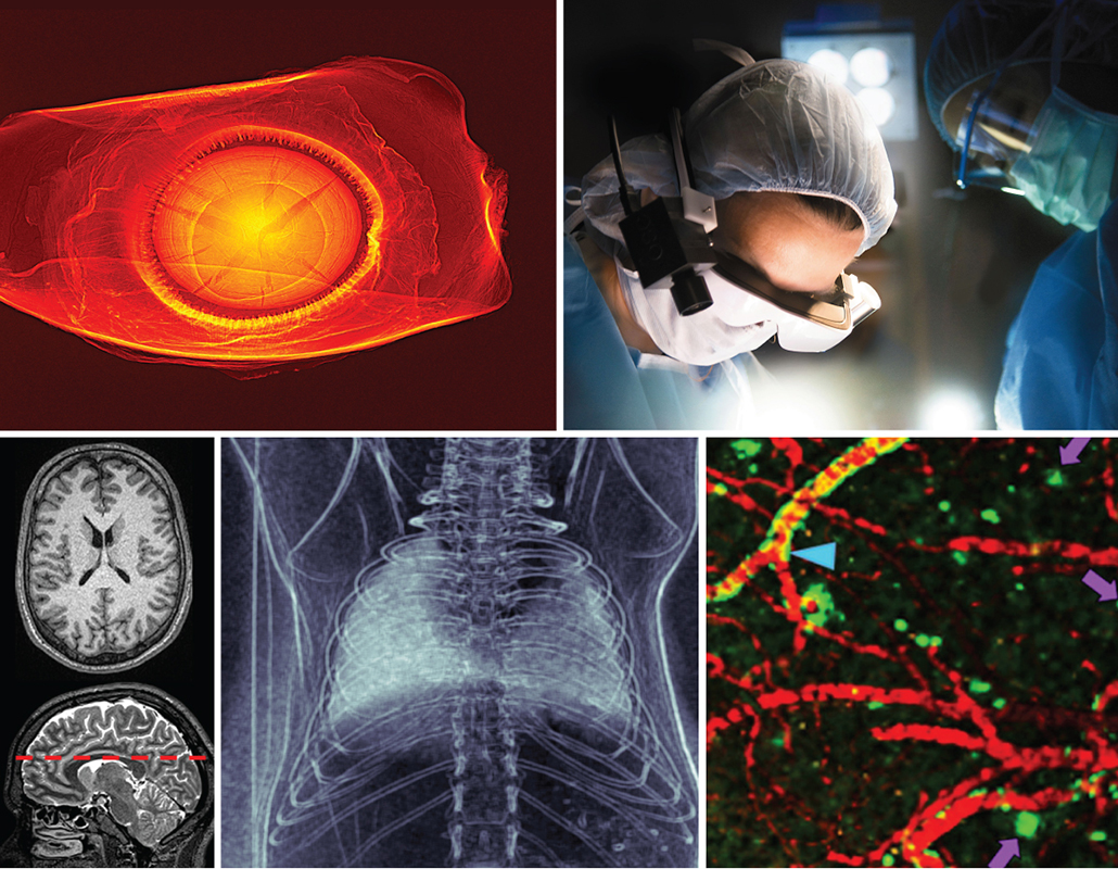 Washington University invests $25 million in imaging sciences – WashU ...