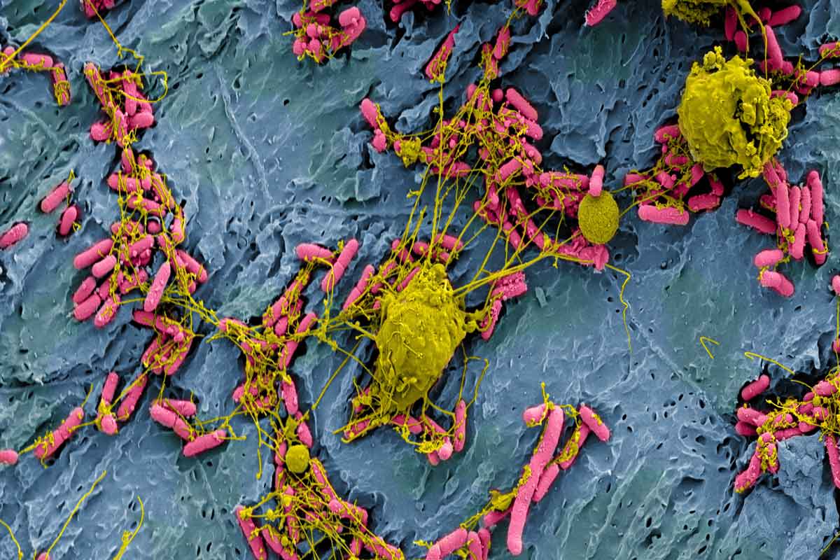 Washington University image a winner in BioArt competition – WashU Medicine