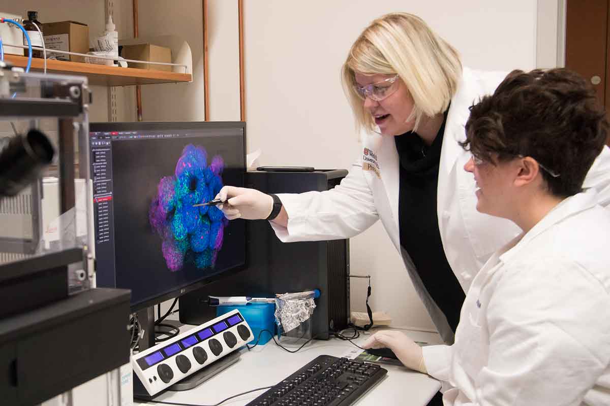 ‘Mini-guts’ offer clues to pediatric GI illness – WashU Medicine