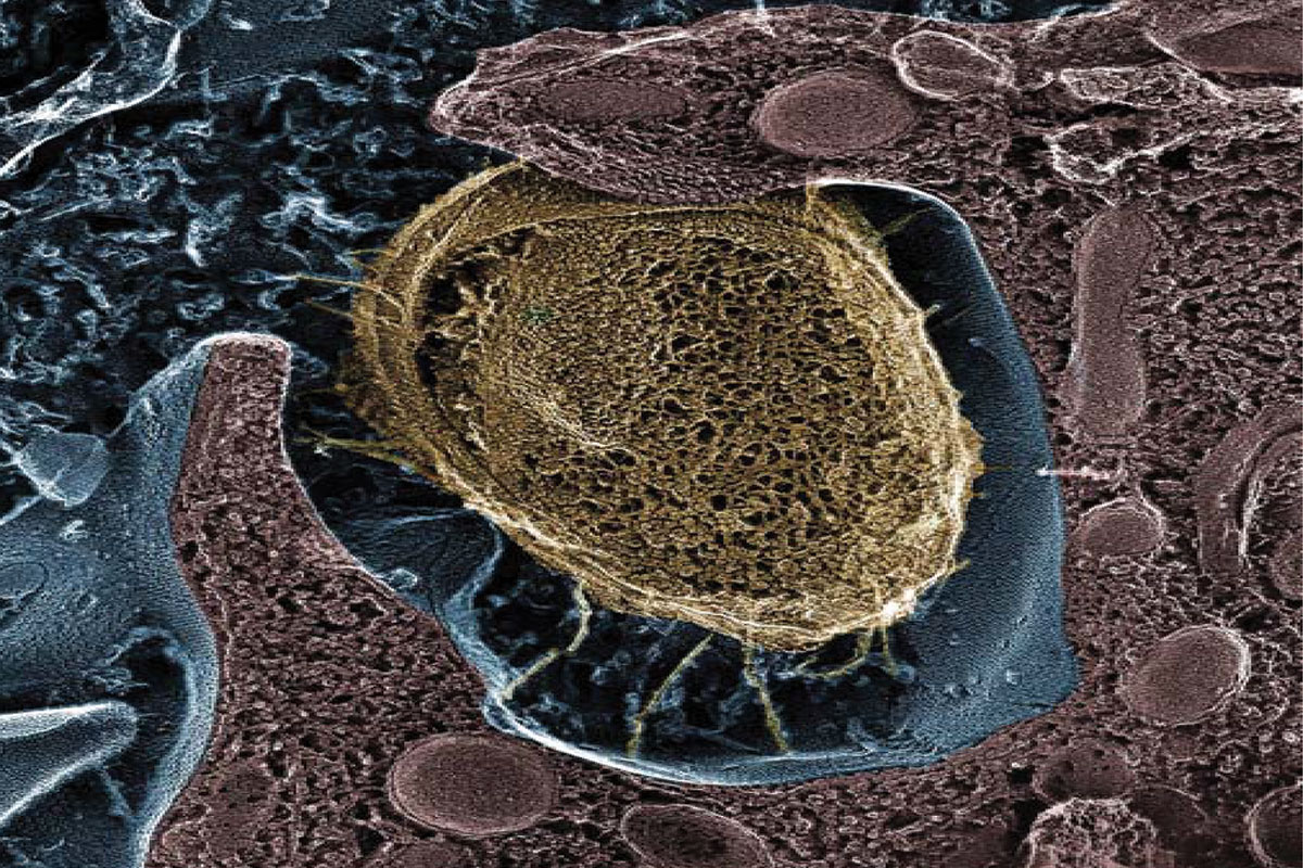 Urinary Tract Infection Bacteria Microscope