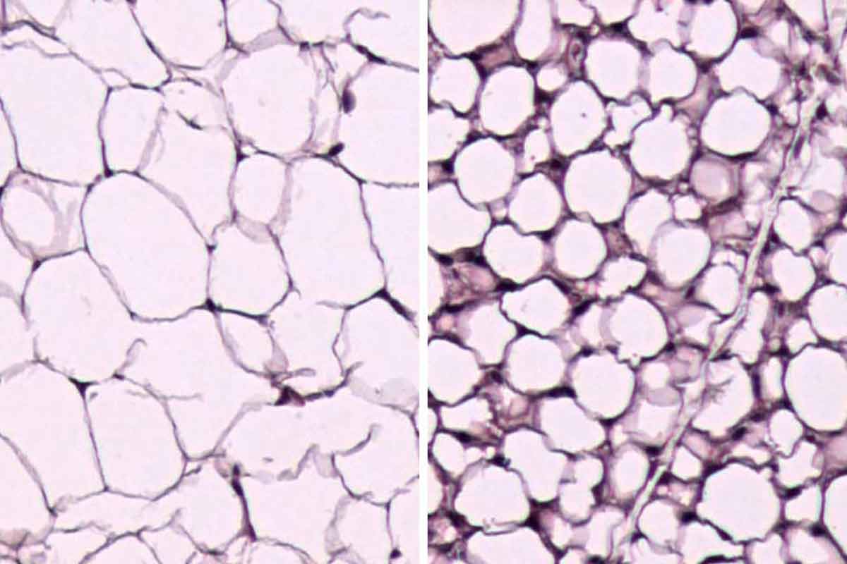 Body’s ‘bad fat’ could be altered to combat obesity, say scientists ...