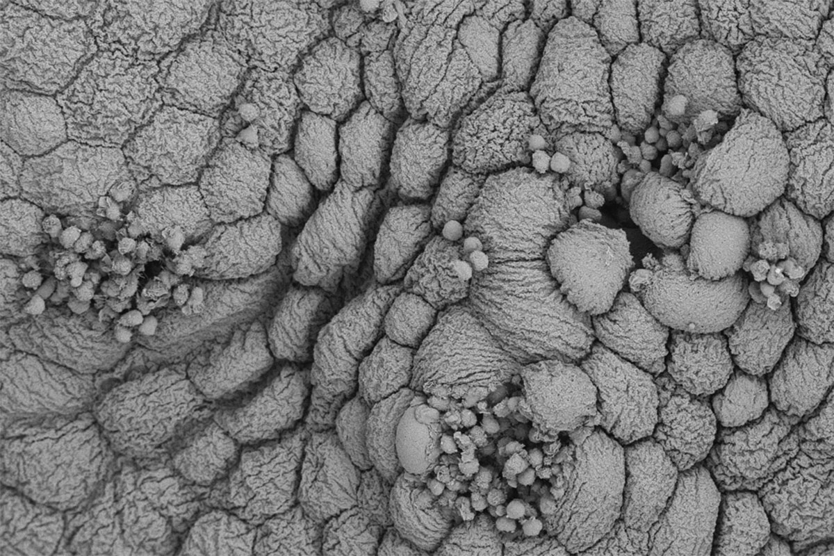 Why initial UTIs increase susceptibility to further infection – WashU ...