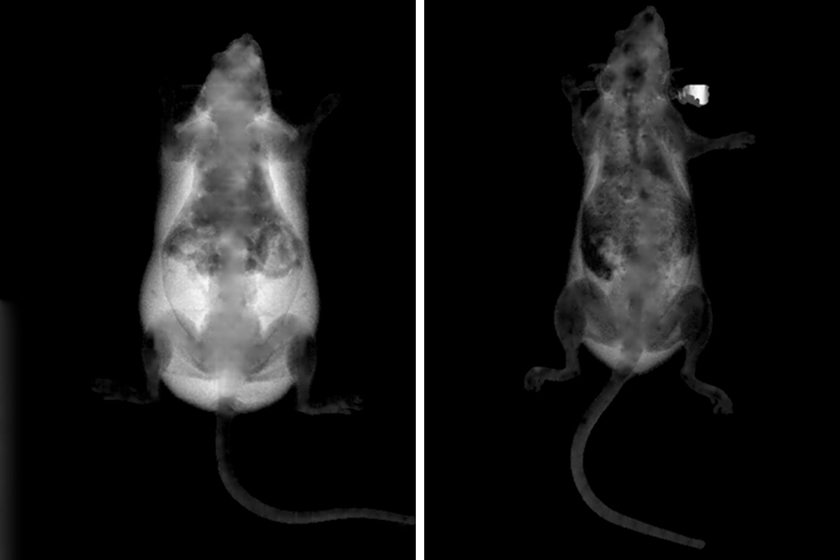 Obesity prevented in mice treated with gene-disabling nanoparticles ...