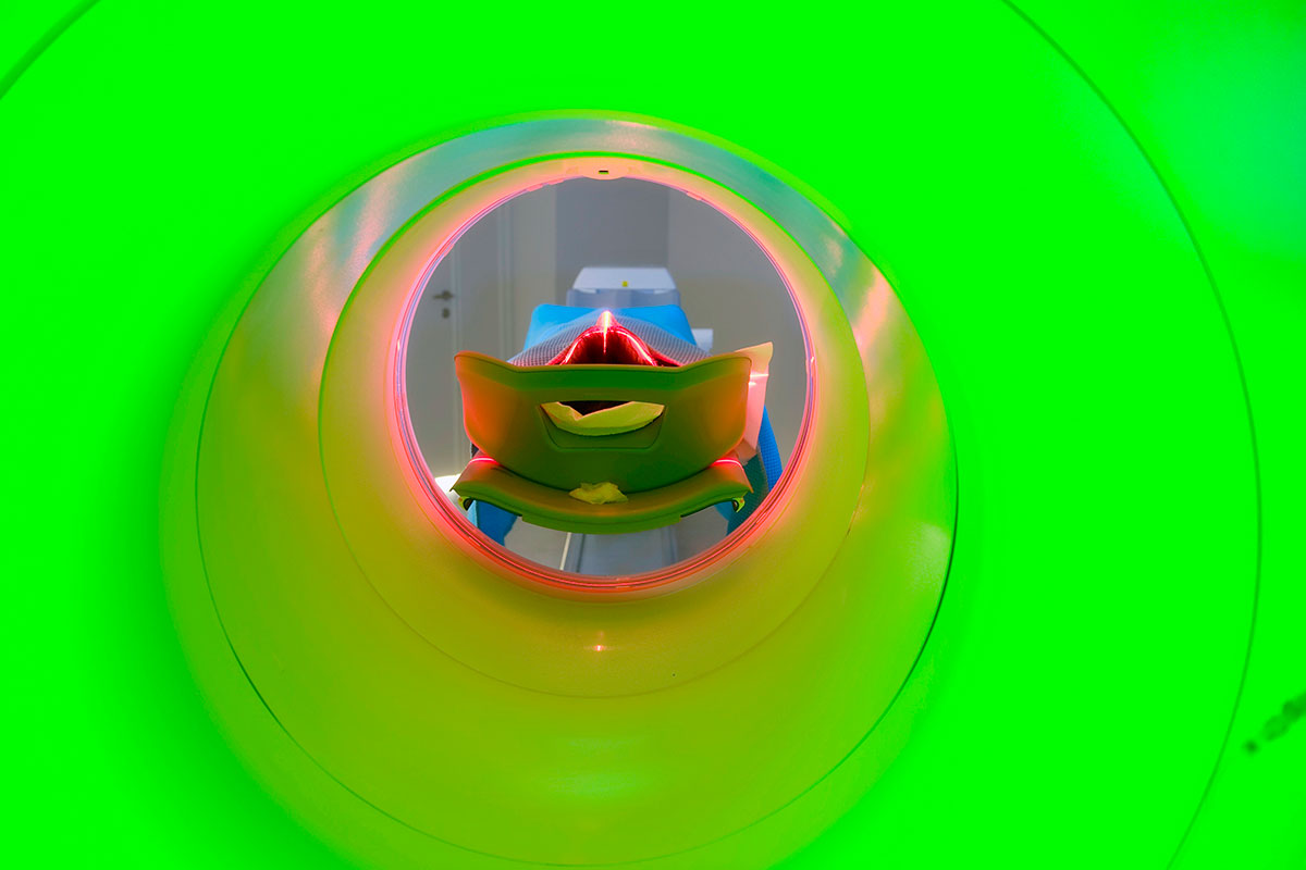 Imaging agent developed at Washington University spotlights ...