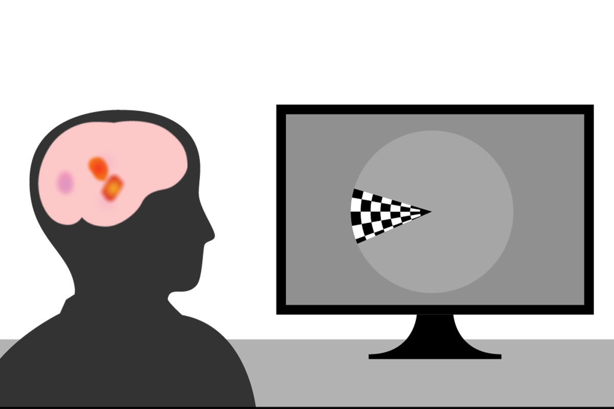 Brain signals decoded to determine what a person sees – WashU Medicine